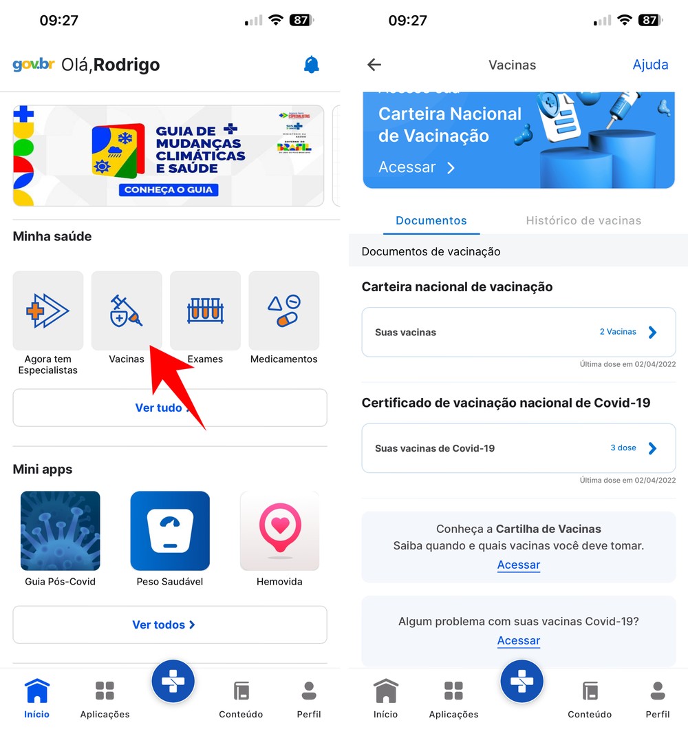 Meu SUS Digital Vacinas: tire suas dúvidas e veja como baixar sua carteira