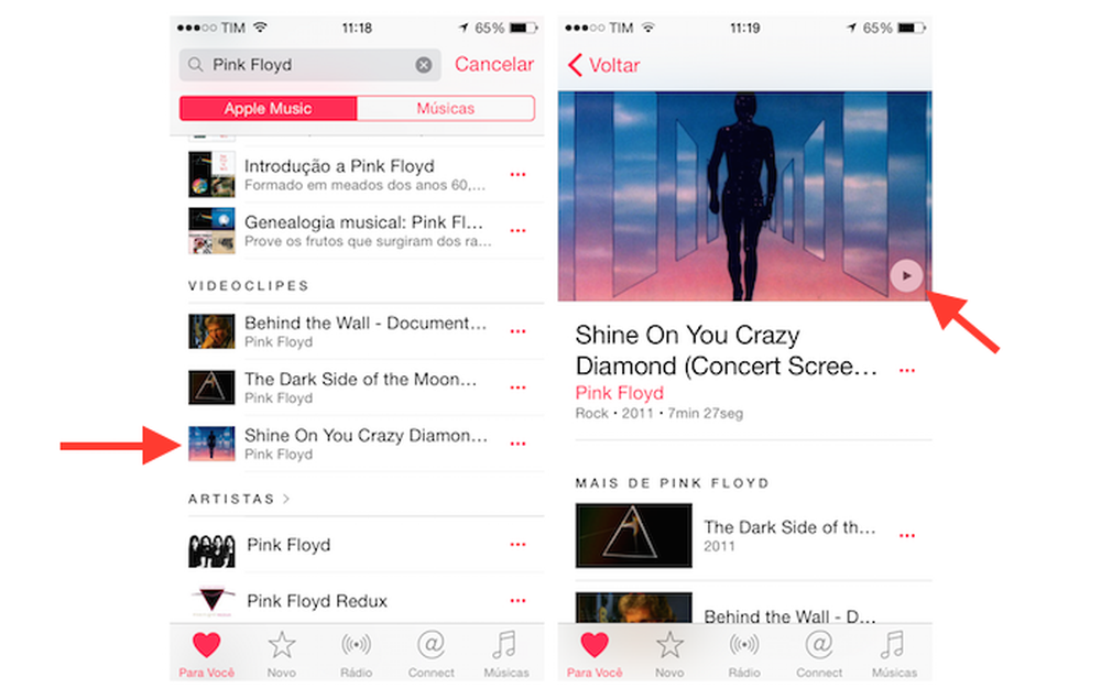 Como assistir clipes de artistas no Apple Music pelo iPhone?