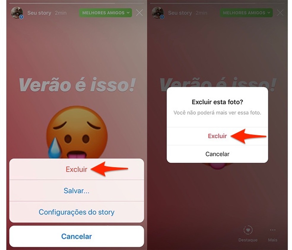 Como Apagar Stories Do Instagram