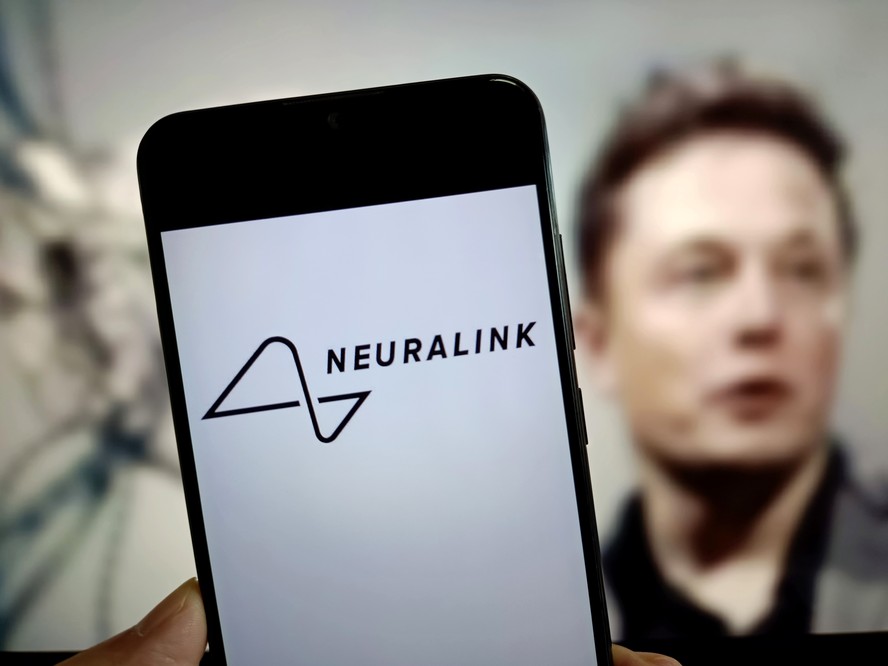 Neuralink Primeiro Humano Recebe Implante De Chip Cerebral De Elon Musk